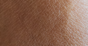 3 Common Strawberry Legs Causes - Realistic Reads